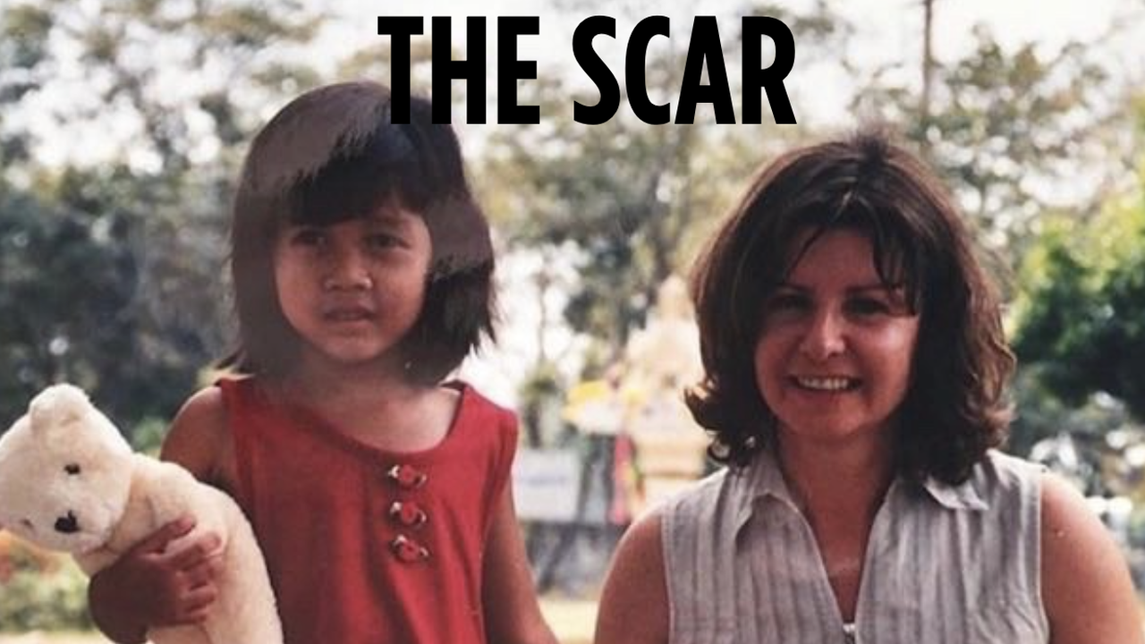 Film autobiographique : THE SCAR - Ulule