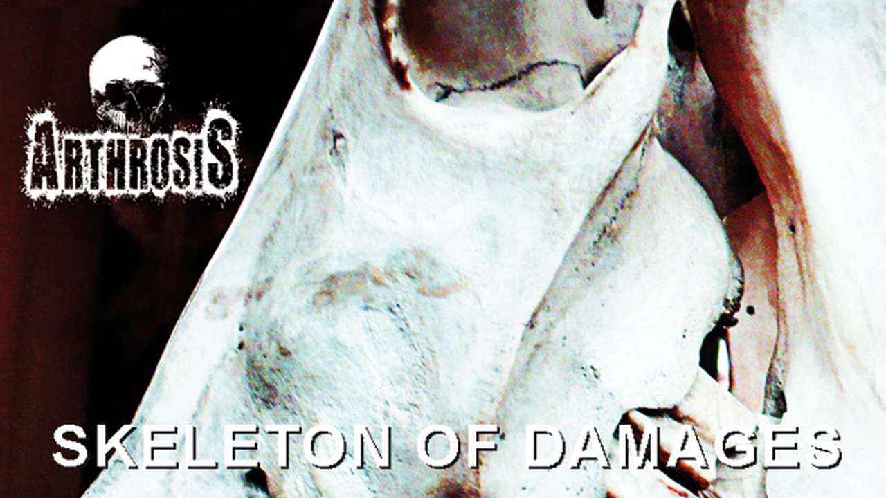 CD EP ARTHROSIS Skeleton of Damages